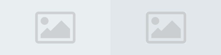 Canthoplasty and Canthopexy | Dr. Sarah Avila